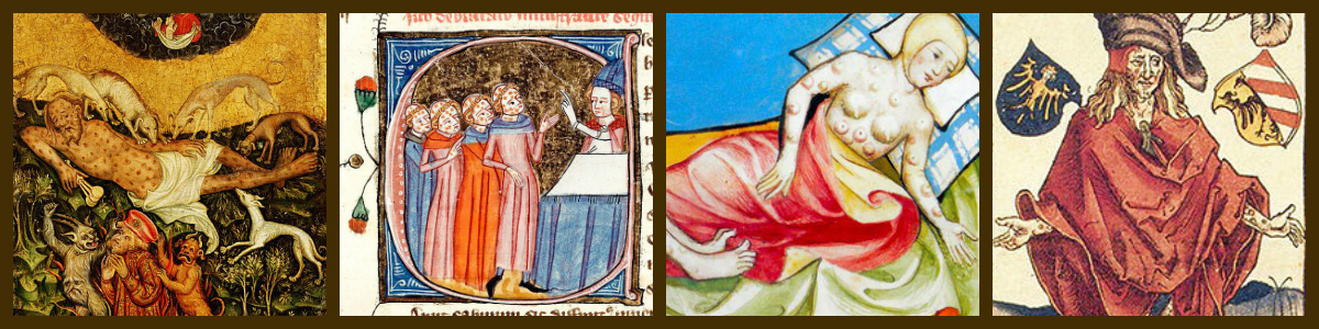 And Mine Lippes Blaken: 5 Medieval Medical Conditions That Made You ...